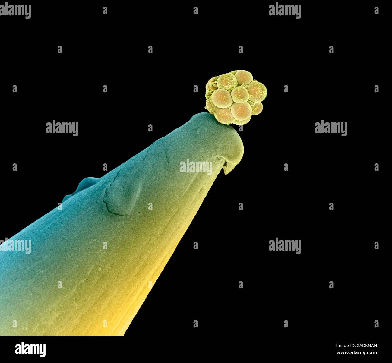 Human embryo. Coloured scanning electron micrograph (SEM) of a human ...