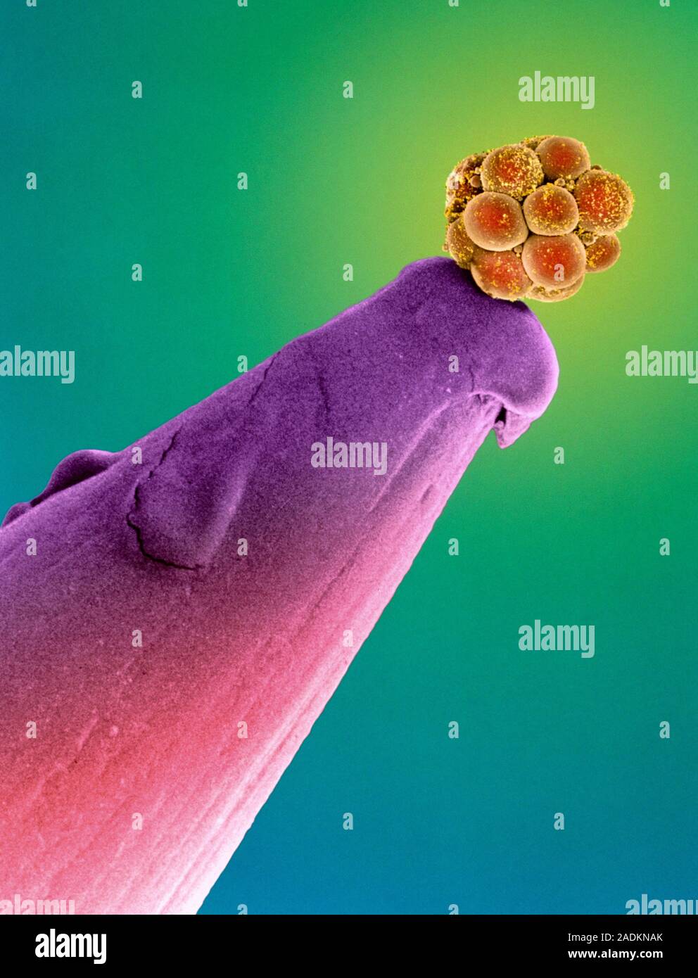 Human embryo. Coloured scanning electron micrograph (SEM) of a human ...