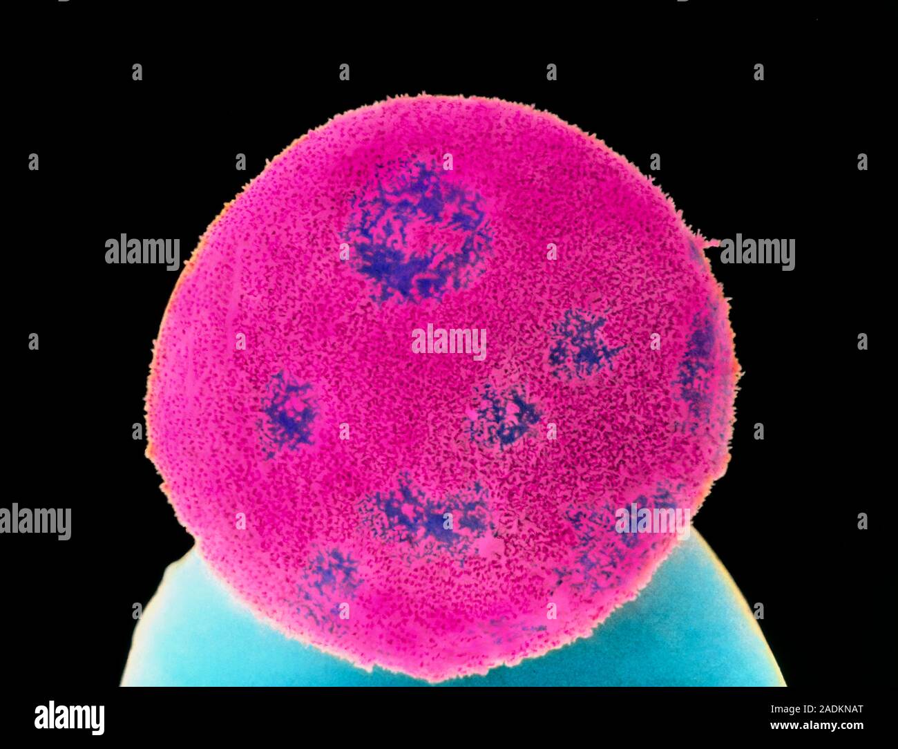 Unhatched blastocyst embryo. Coloured scanning electron micrograph (SEM ...