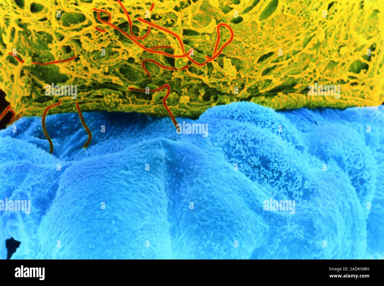 Hatching blastocyst embryo. Coloured scanning electron micrograph (SEM ...