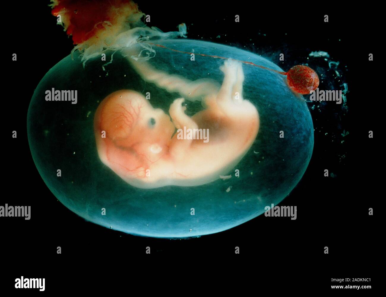 Human embryo. View of a human embryo at 7-8 weeks old, known as a first ...
