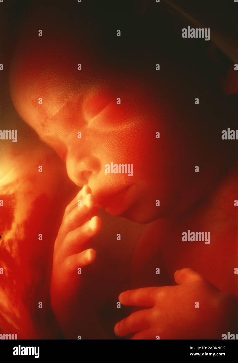 Five month old foetus. View of a five month (20 week) old male foetus ...