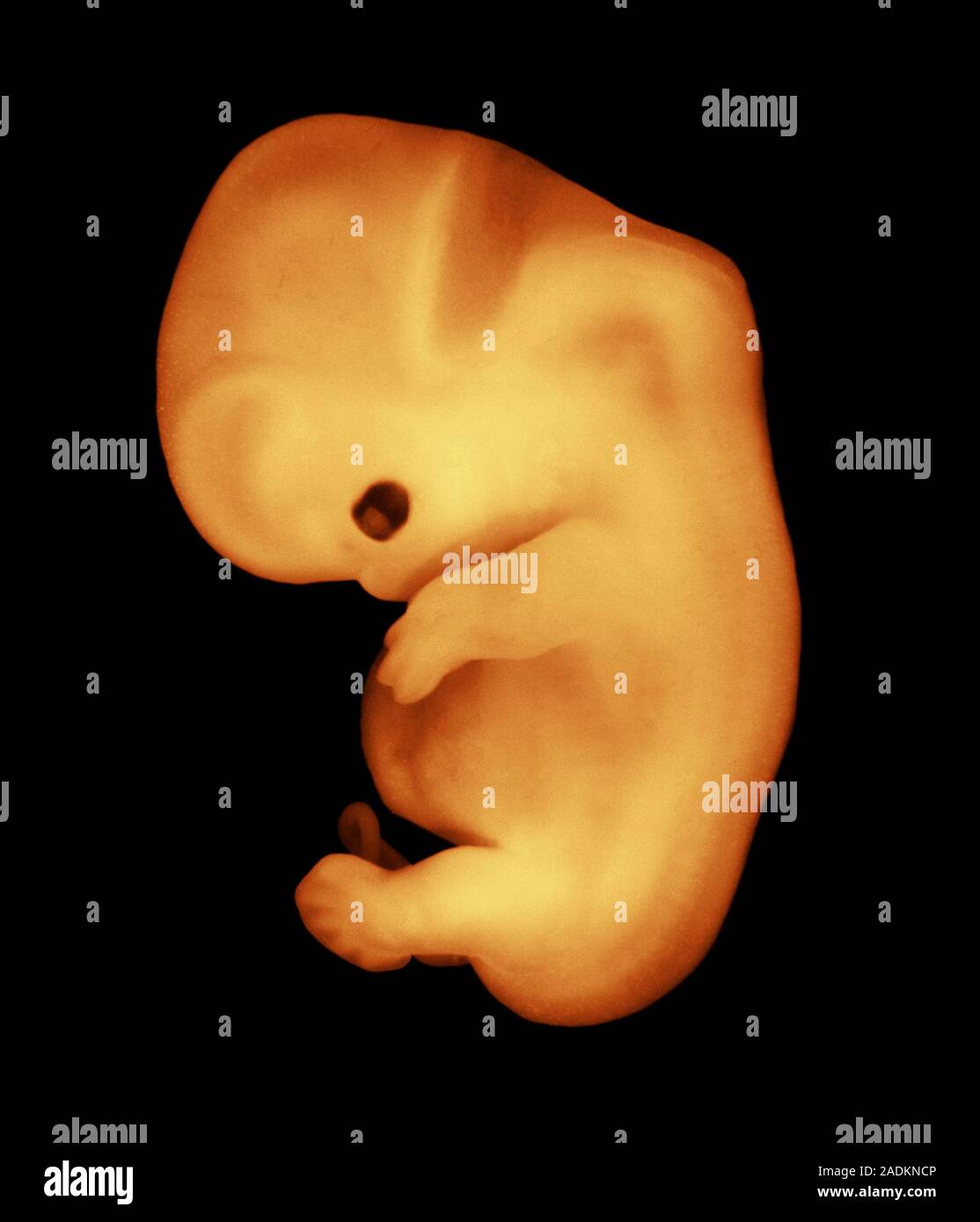 Human embryo. Coloured side view of a 6 week (44 day) old human embryo ...