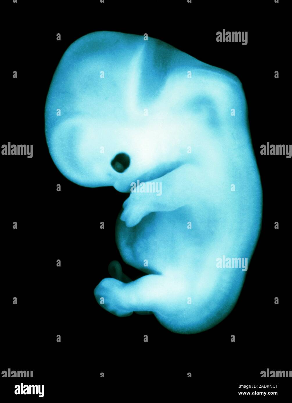 Human embryo. Coloured side view of a 6 week (44 day) old human embryo ...