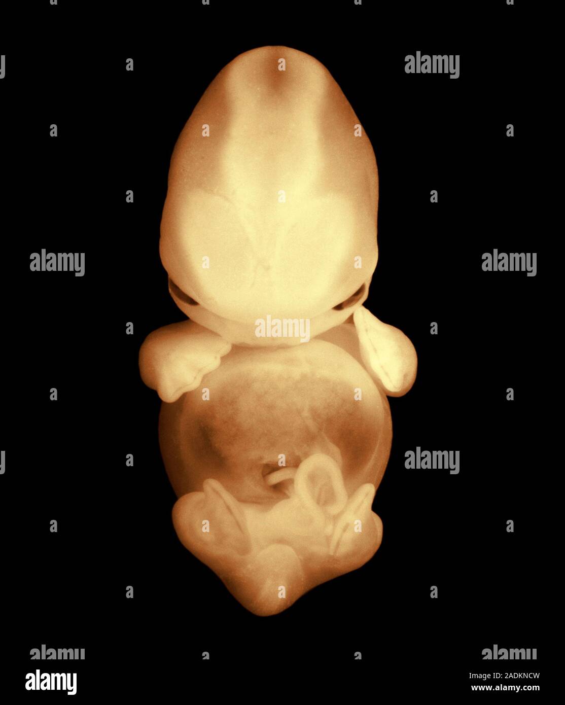 Human embryo. Coloured frontal view of a 6 week (44 day) old human ...
