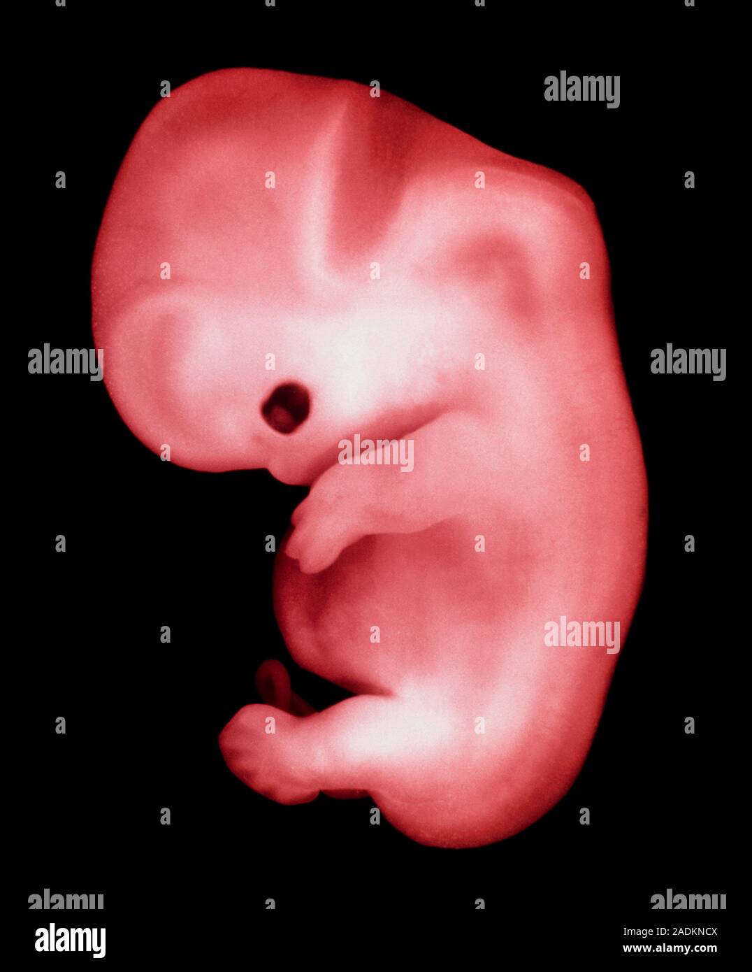 Human embryo. Coloured side view of a 6 week (44 day) old human embryo ...