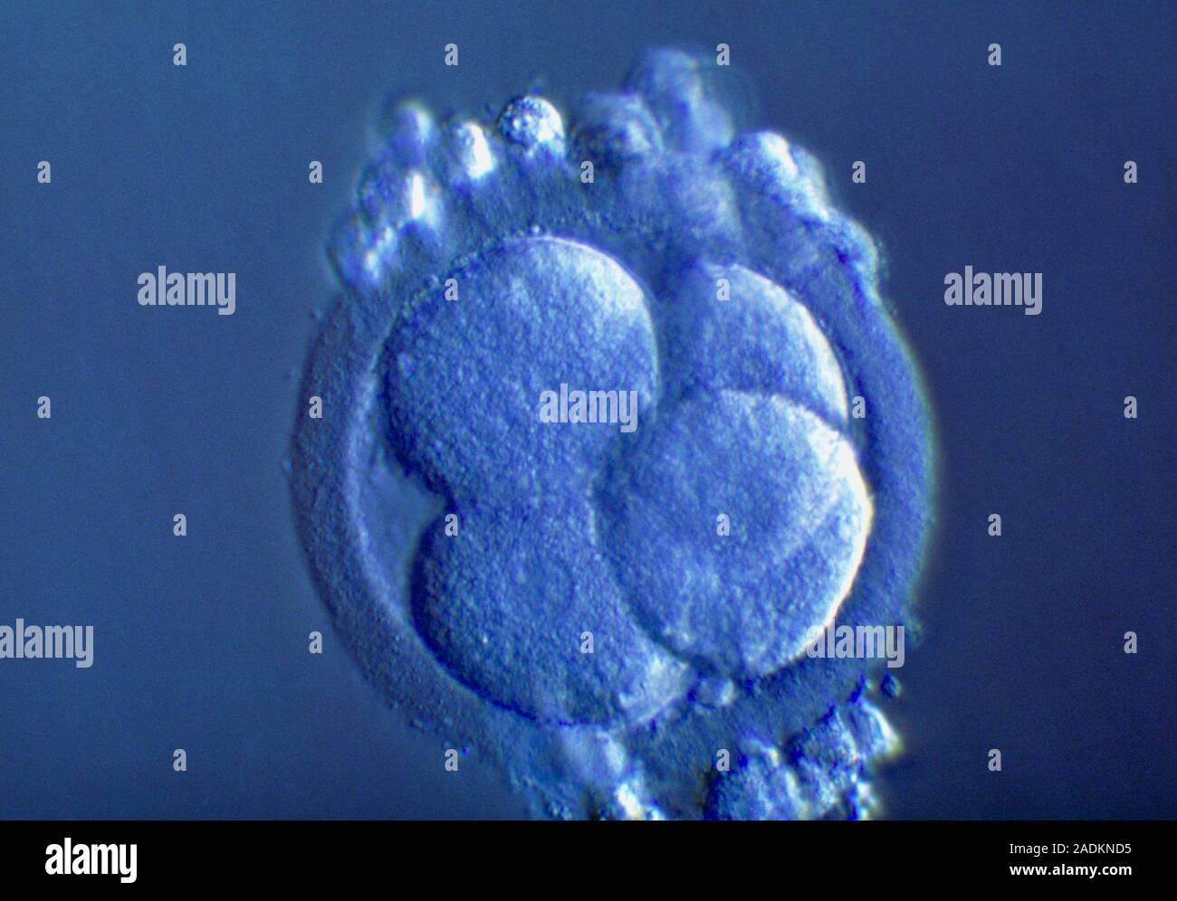Four-cell embryo. Image 1 of 4. Light micrograph of the cells ...