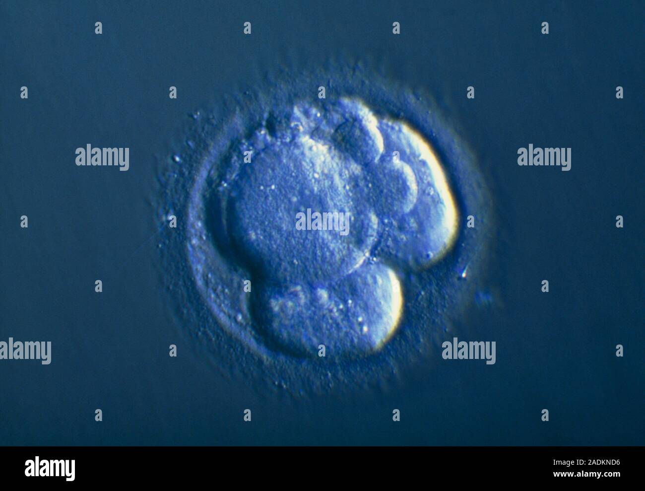 Four-cell embryo. Image 2 of 4. Light micrograph of the cells ...