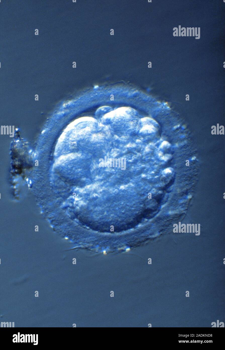 Four-cell embryo. Image 4 of 4. Light micrograph of the cells ...