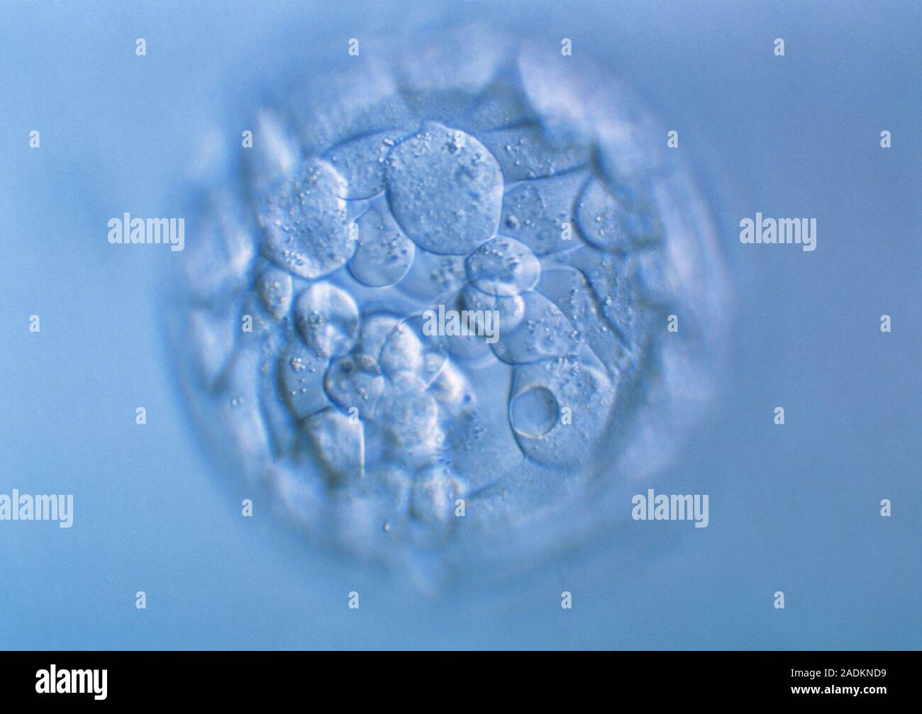 Blastocyst embryo. Light micrograph of a human embryo at the blastocyst ...