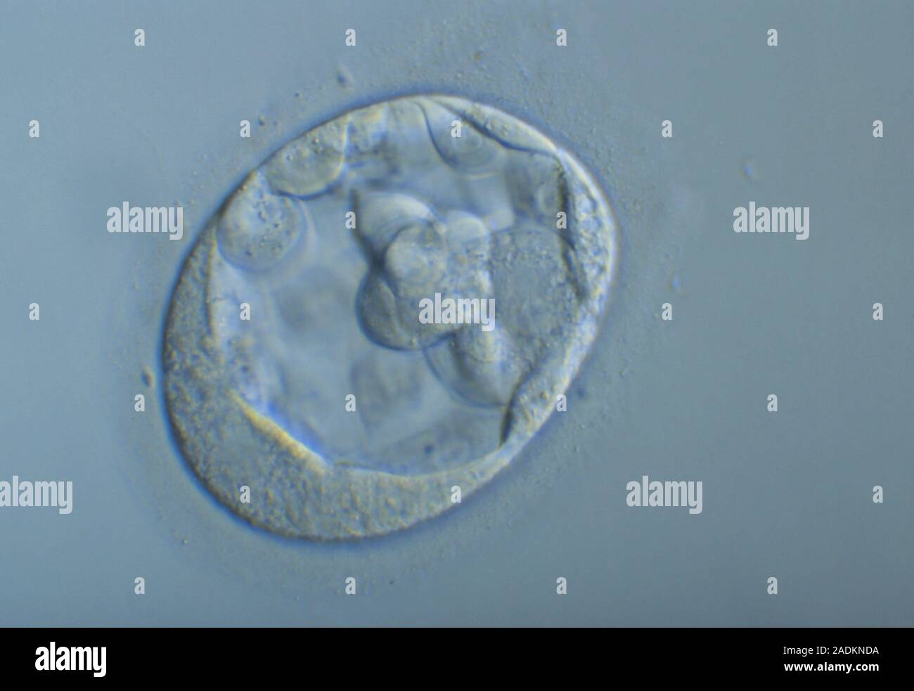 Blastocyst embryo. Light micrograph of a human embryo at the blastocyst ...