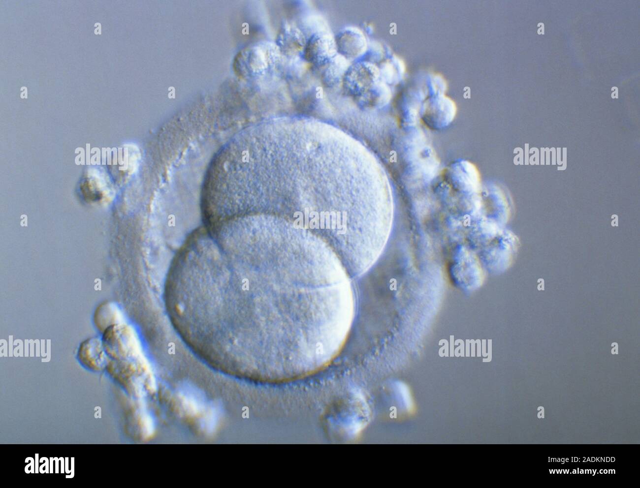 Two-cell embryo. Light micrograph of a 2-cell human embryo. The cells ...