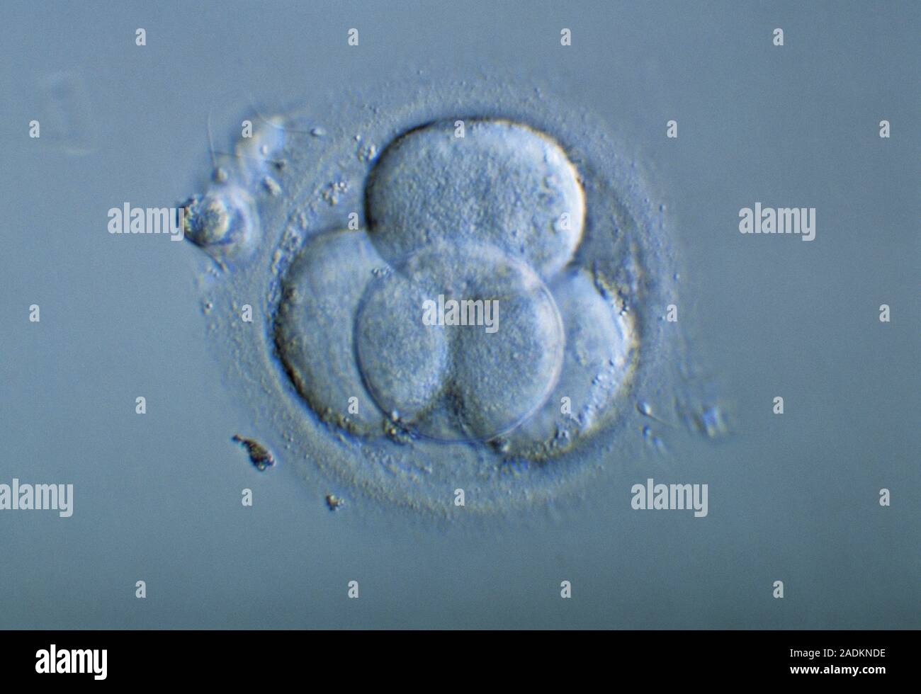 Four-cell embryo. Light micrograph of a 4-cell human embryo. The cells ...