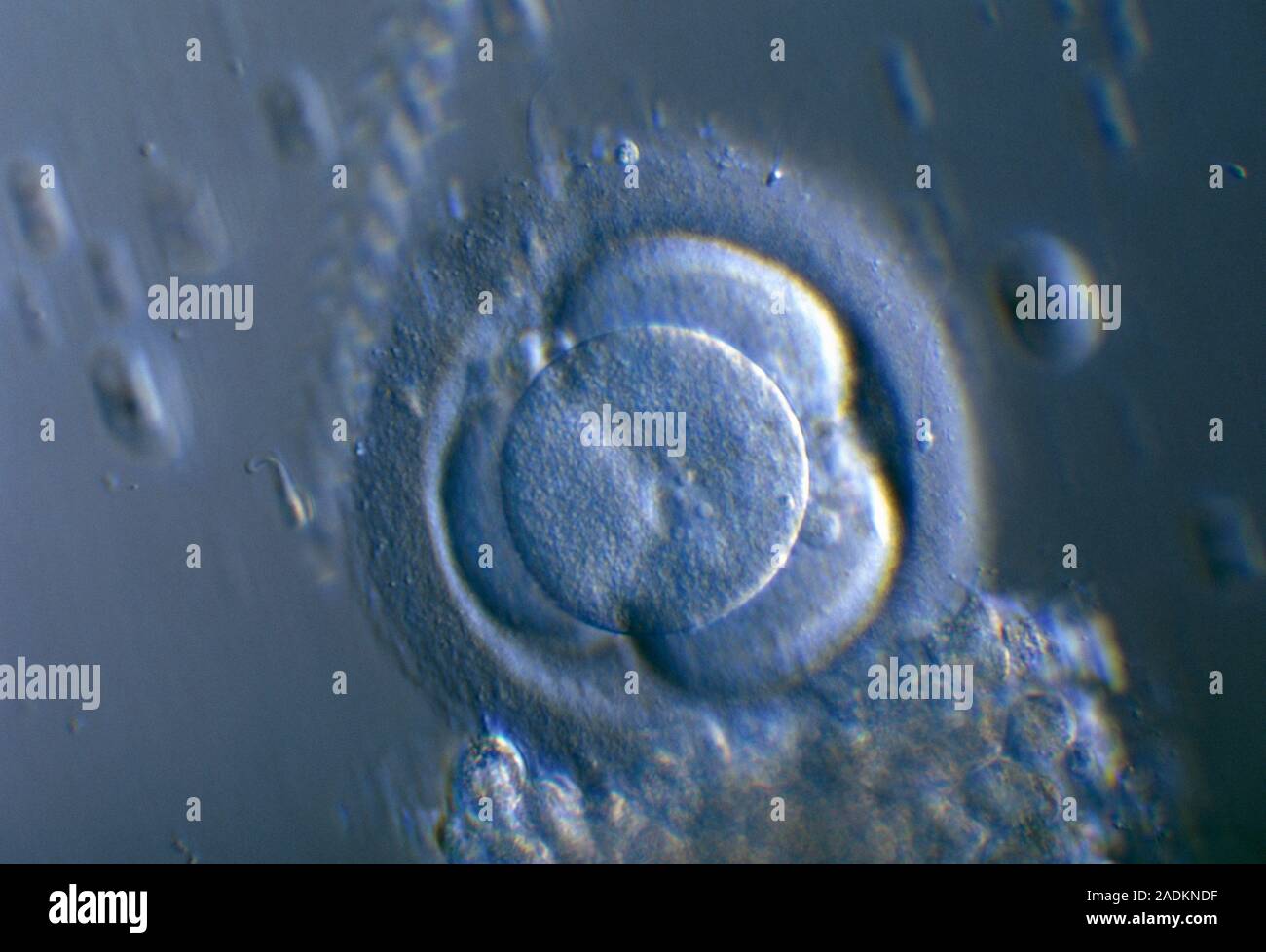 Four-cell embryo. Light micrograph of a 4-cell human embryo. The cells ...