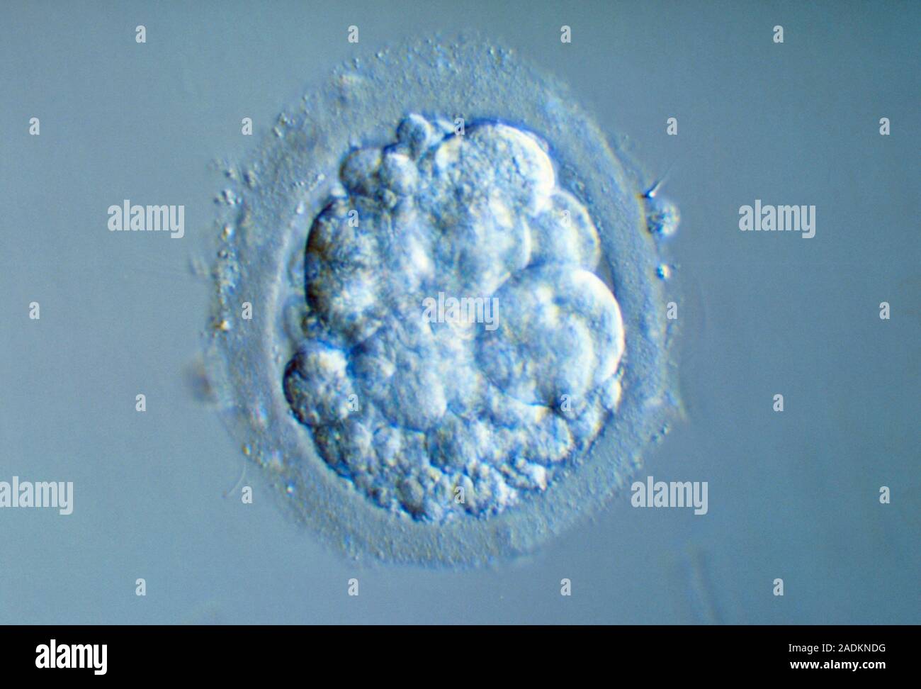 Aborting embryo. Light micrograph of a human embryo aborting at the 4 ...