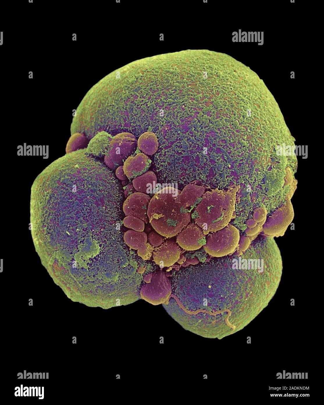 Four-cell embryo. Coloured scanning electron micrograph (SEM) of a ...