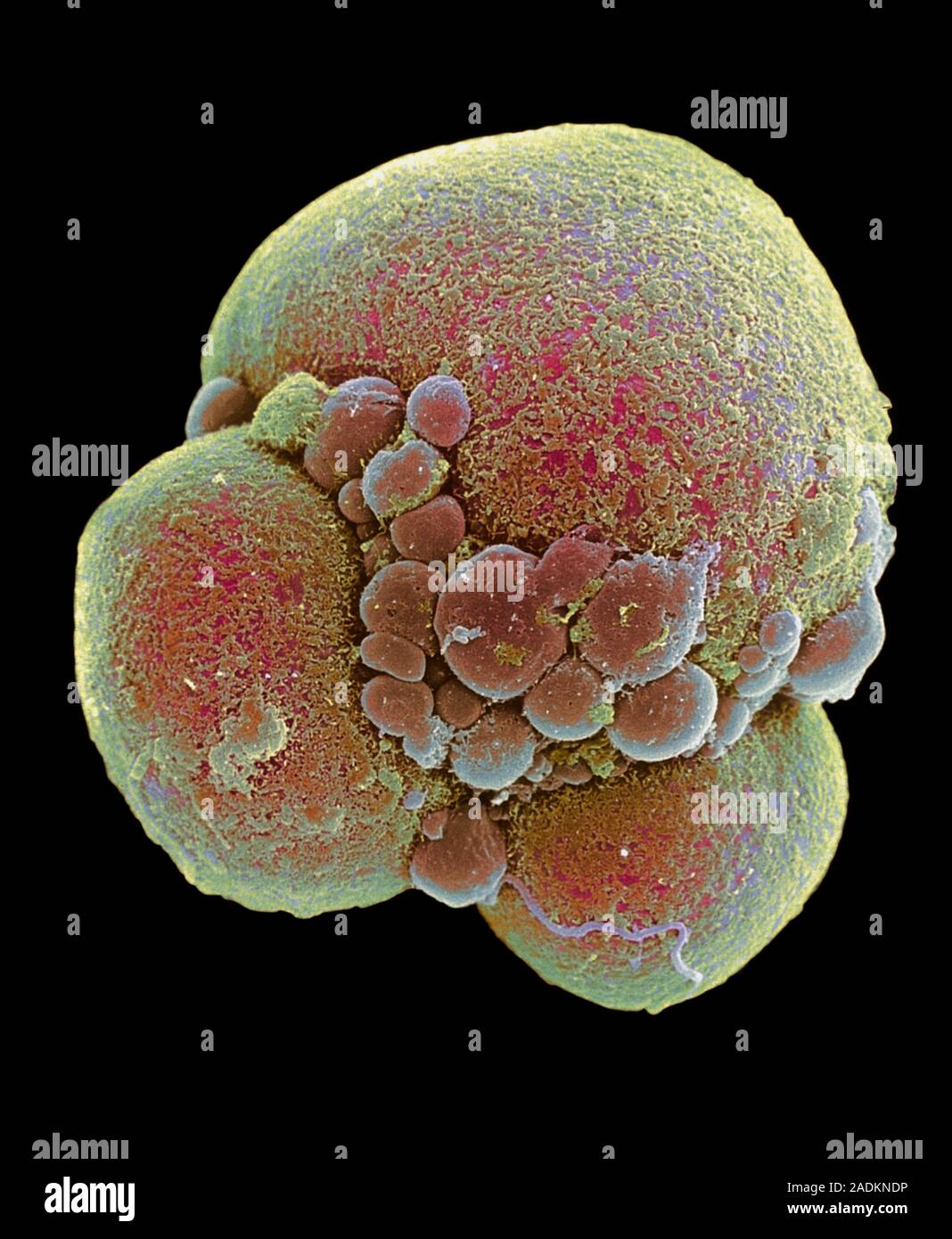 Four-cell embryo. Coloured scanning electron micrograph (SEM) of a ...