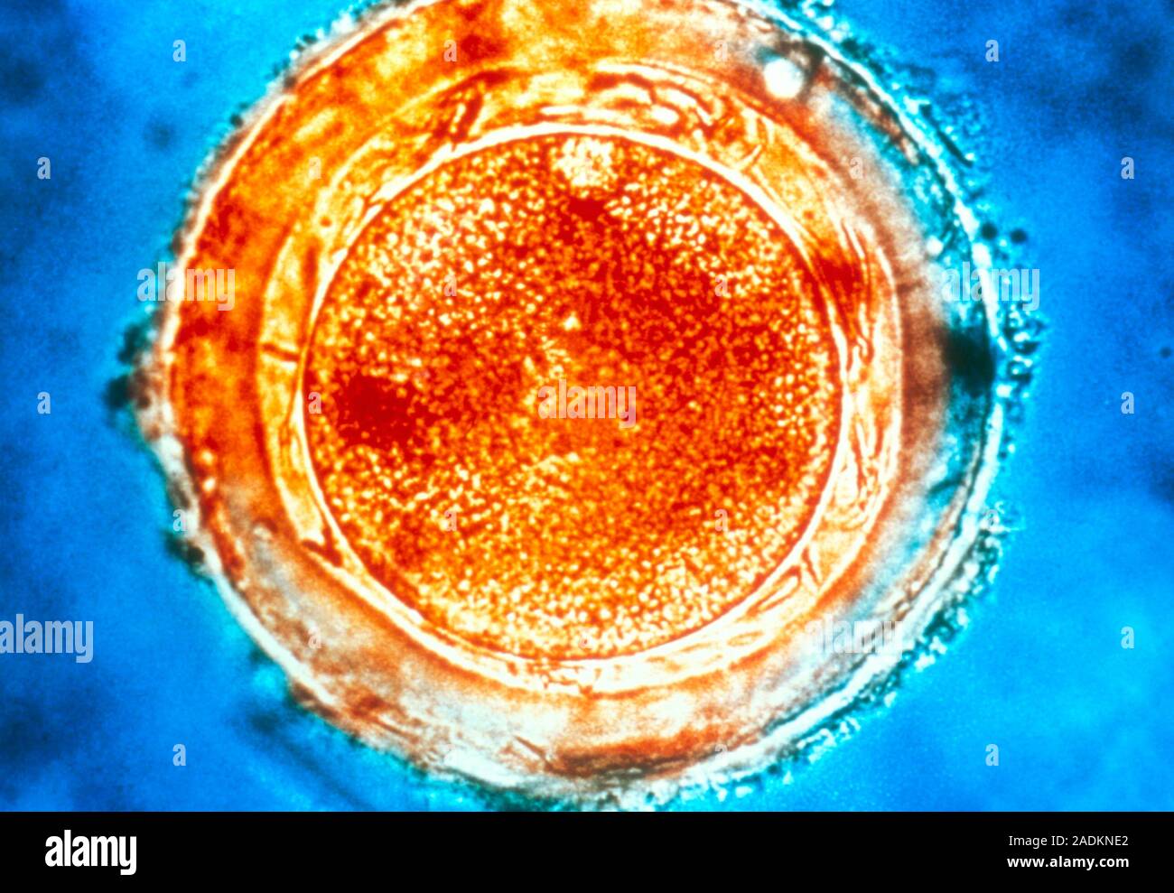 Fertilised egg. Image 1 of 4. Light micrograph of a fertilised human ...