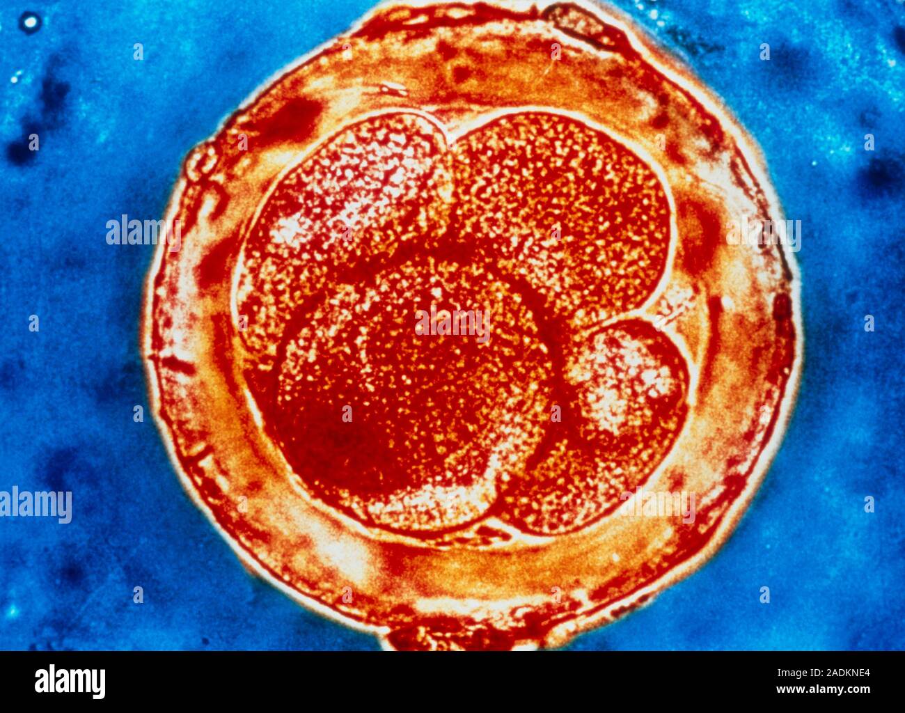 Four-cell human embryo. Image 3 of 4. Light micrograph of a human ...