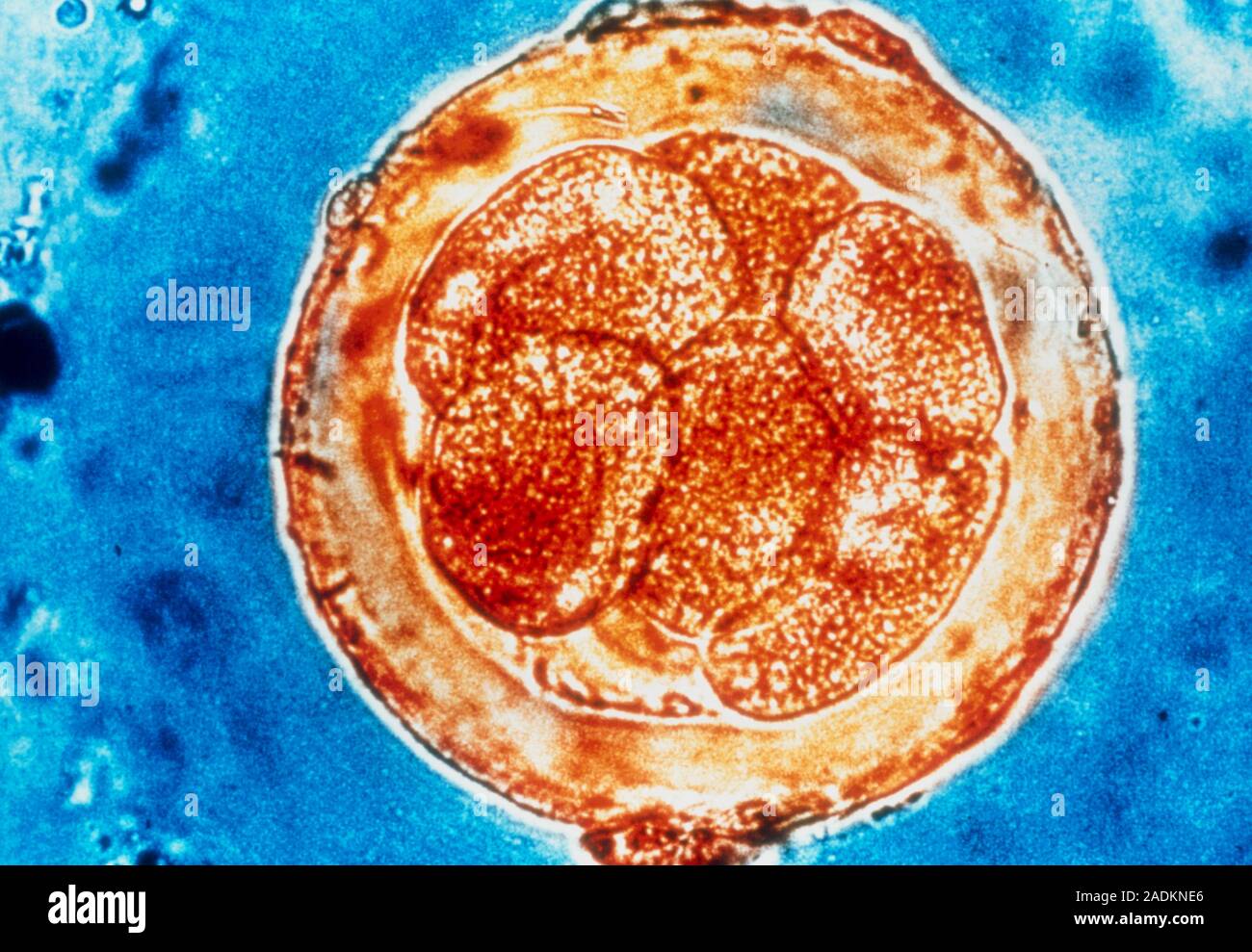 Eight-cell human embryo. Image 4 of 4. Light micrograph of a human embryo at the eight-cell ...