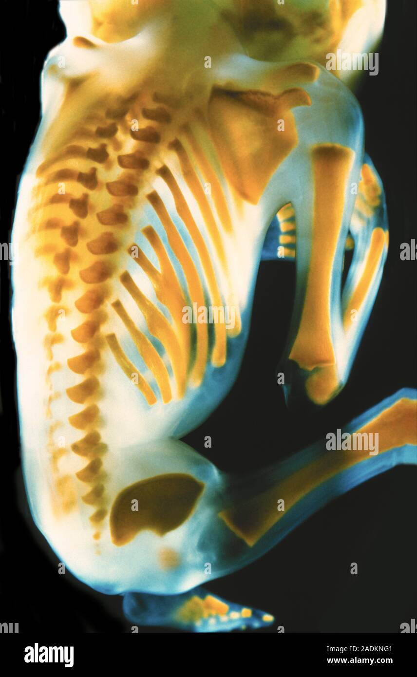 Foetus. Skeleton of a 16 week old human foetus. Hardened bone appears ...