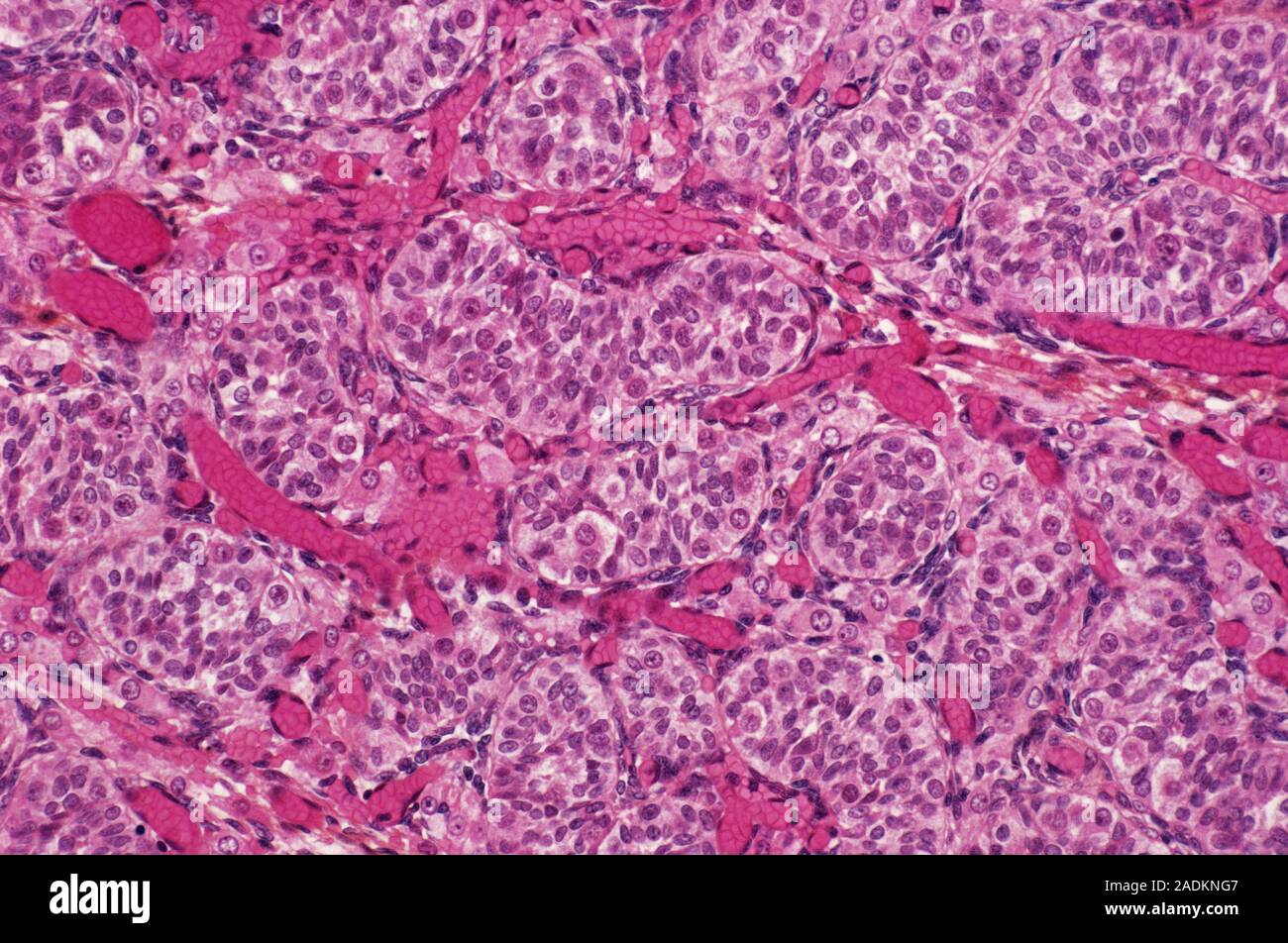Foetal testicular tissue. Light micrograph through testicular tissue ...