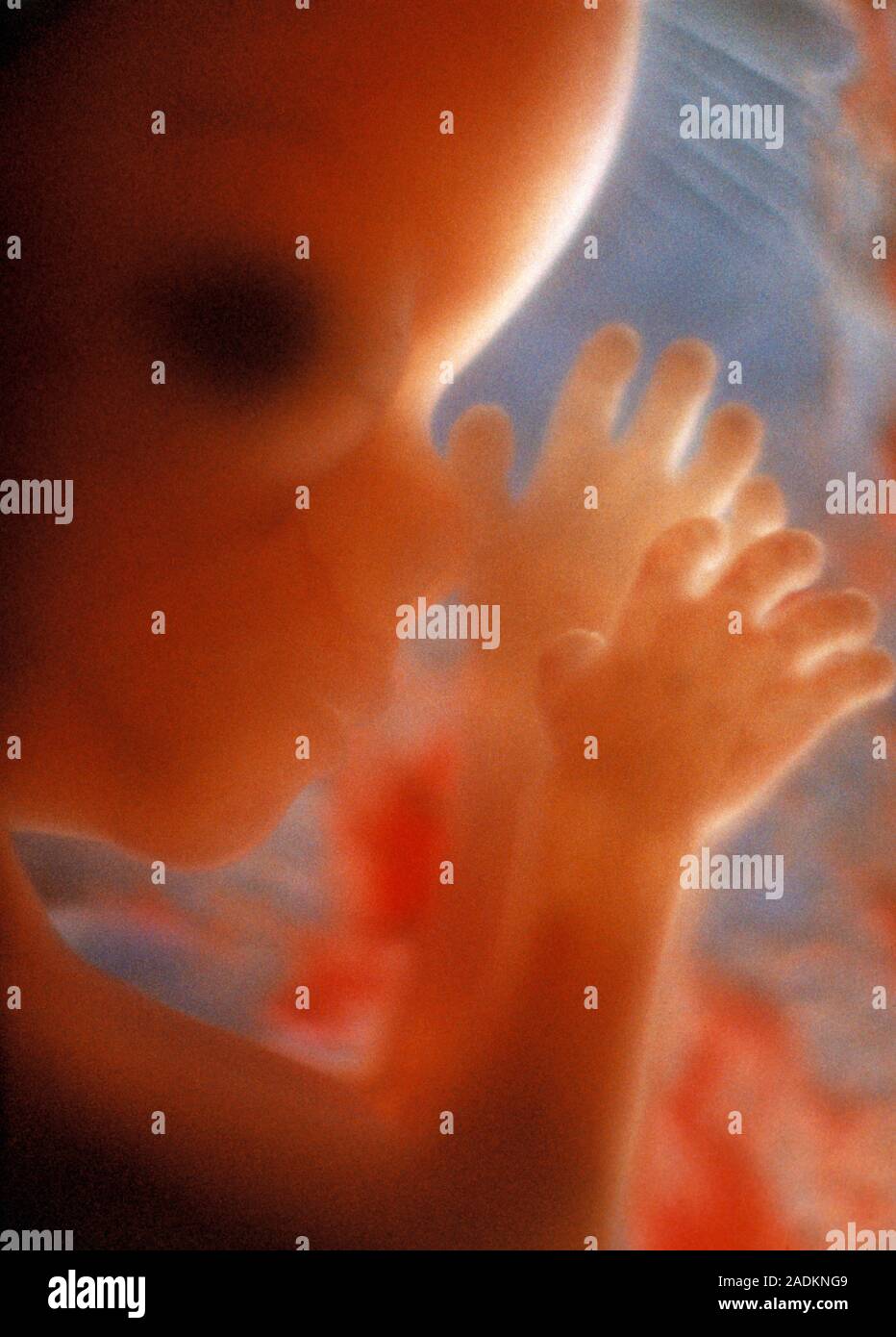 Foetus at 14 weeks. At this stage of development, the foetus has a ...