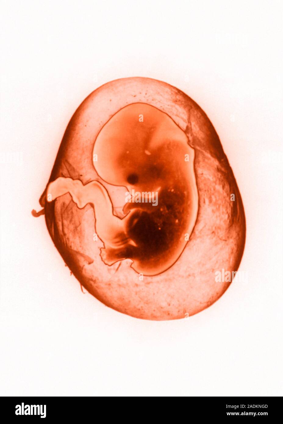 Eight-week-old foetus. This foetus is seen during the end stage of the ...