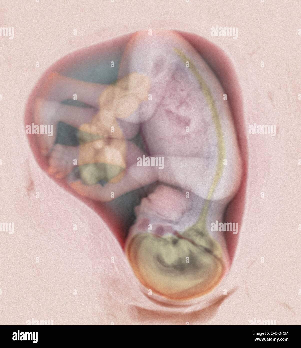 Foetus at 27 weeks, coloured three-dimensional magnetic resonance ...