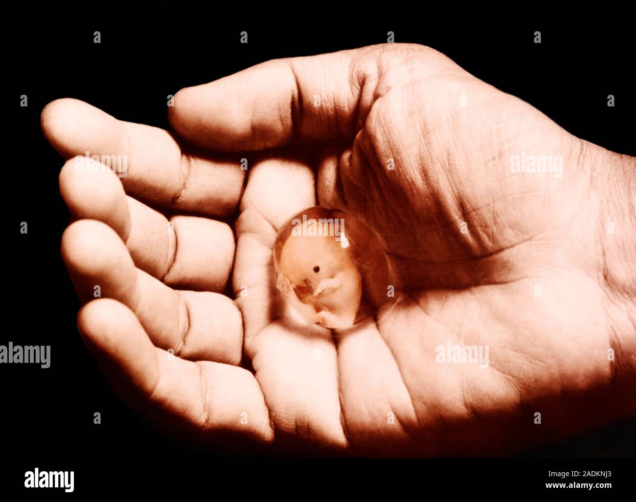 Hand holding foetus. Eight-week human foetus resting in an adult's palm ...