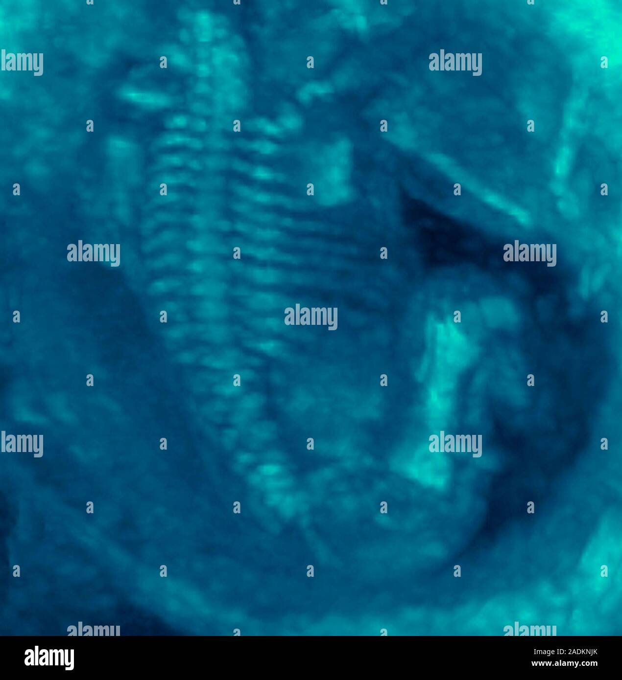 Foetus skeleton. Coloured 3-D ultrasound scan of part of the skeleton ...