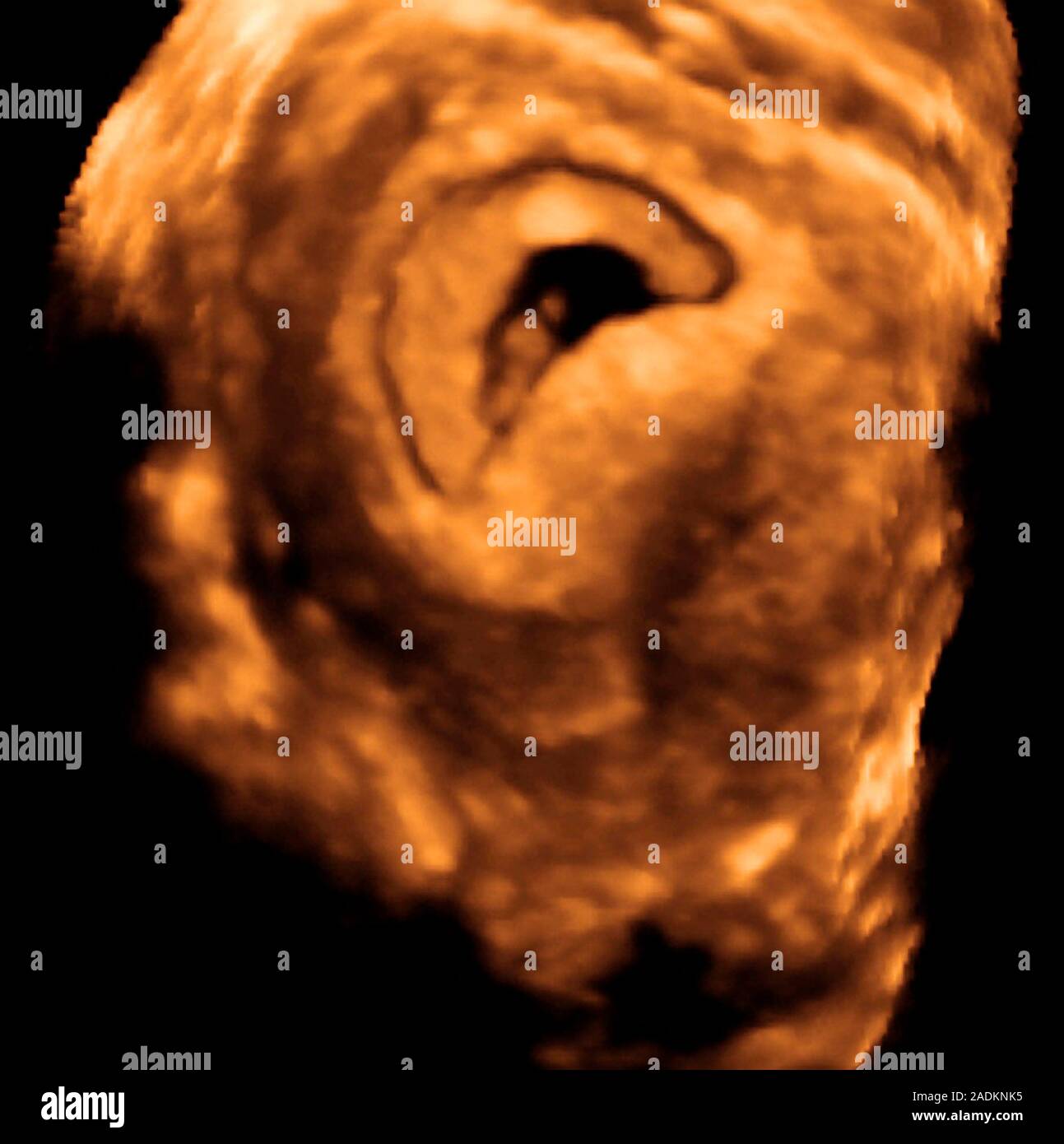 Embryo. Coloured 3-D ultrasound scan of a seven- week-old embryo (upper ...