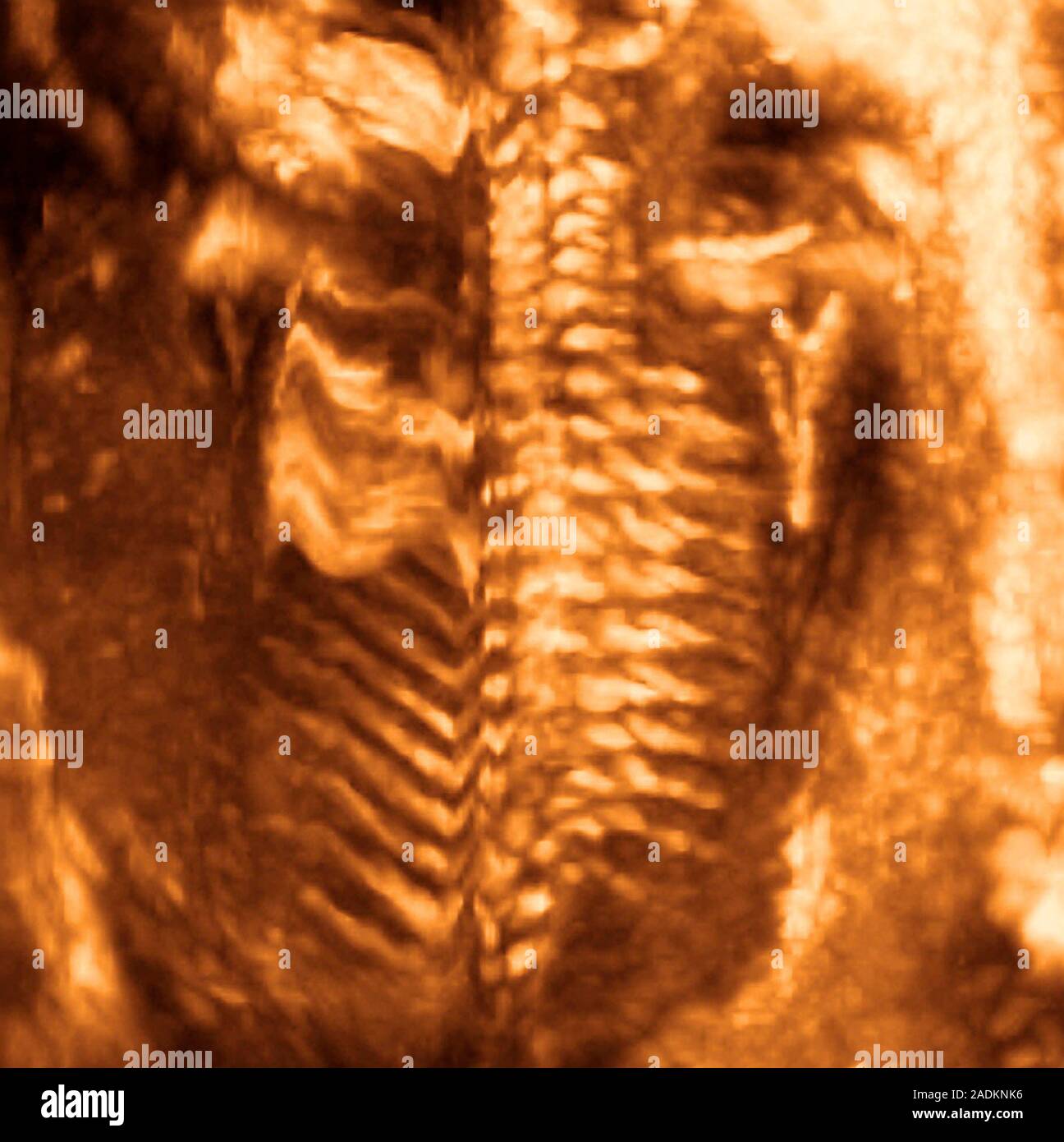 Foetus skeleton. Coloured 3-D ultrasound scan of part of the skeleton ...