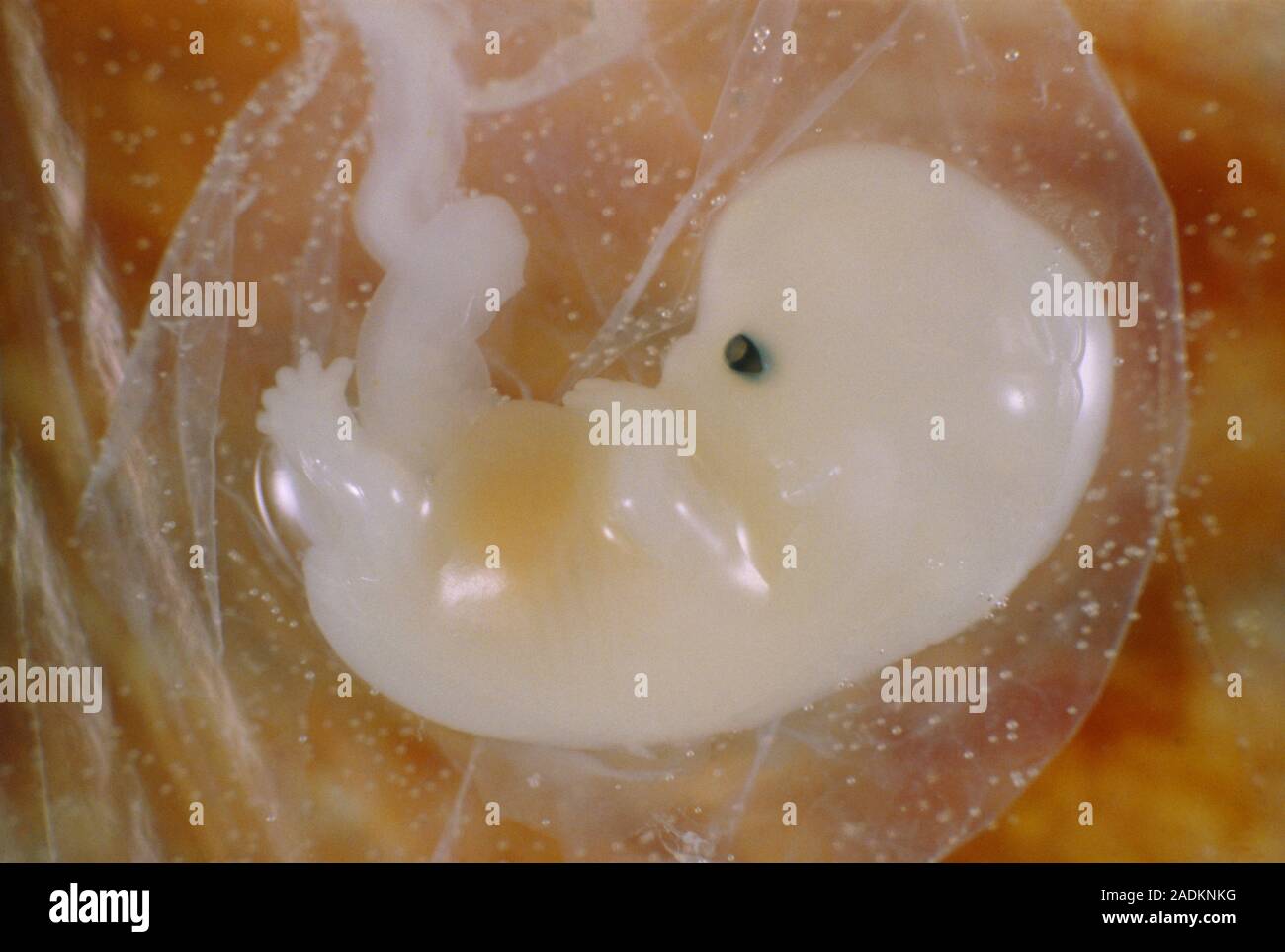 Human embryo. Side view of a five-week-old human embryo seen within its ...