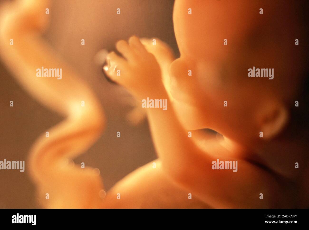 Foetus at 12 weeks. At this stage of development (end of the first ...