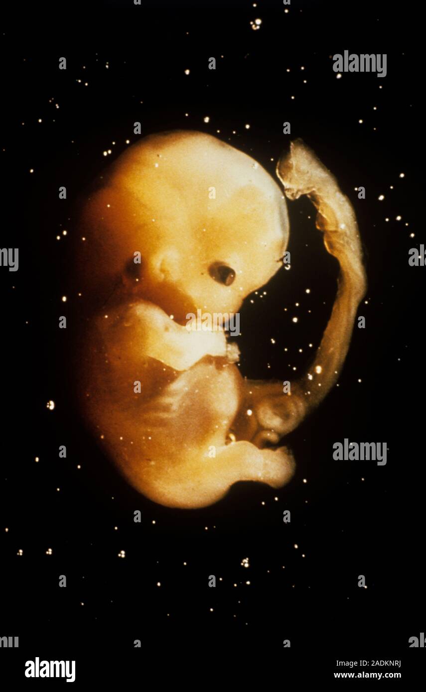 Embryo at seven weeks of age. A developing baby is called an embryo for ...