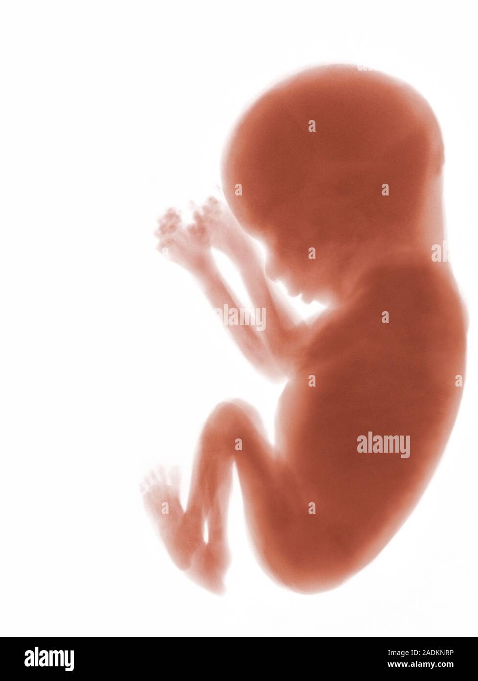 Foetus. Computer artwork of a foetus against an illuminated background ...