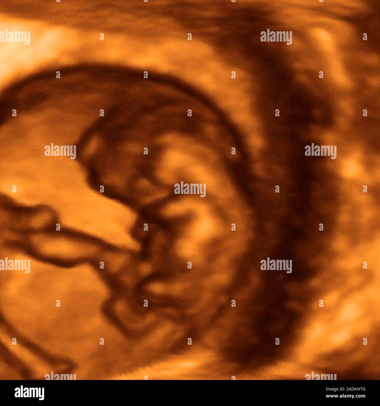 Foetus. Coloured 3-D ultrasound scan of a foetus at nine weeks. This is ...