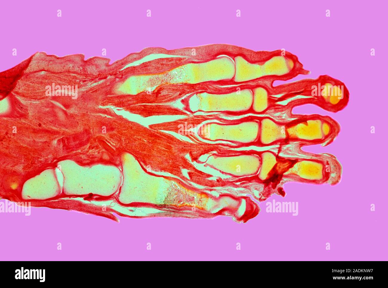 Human foetal hand. Light micrograph of a hand from a human foetus ...