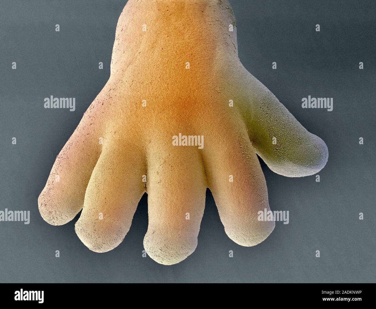 Foetal hand. Coloured scanning electron micrograph (SEM) of a foetal ...