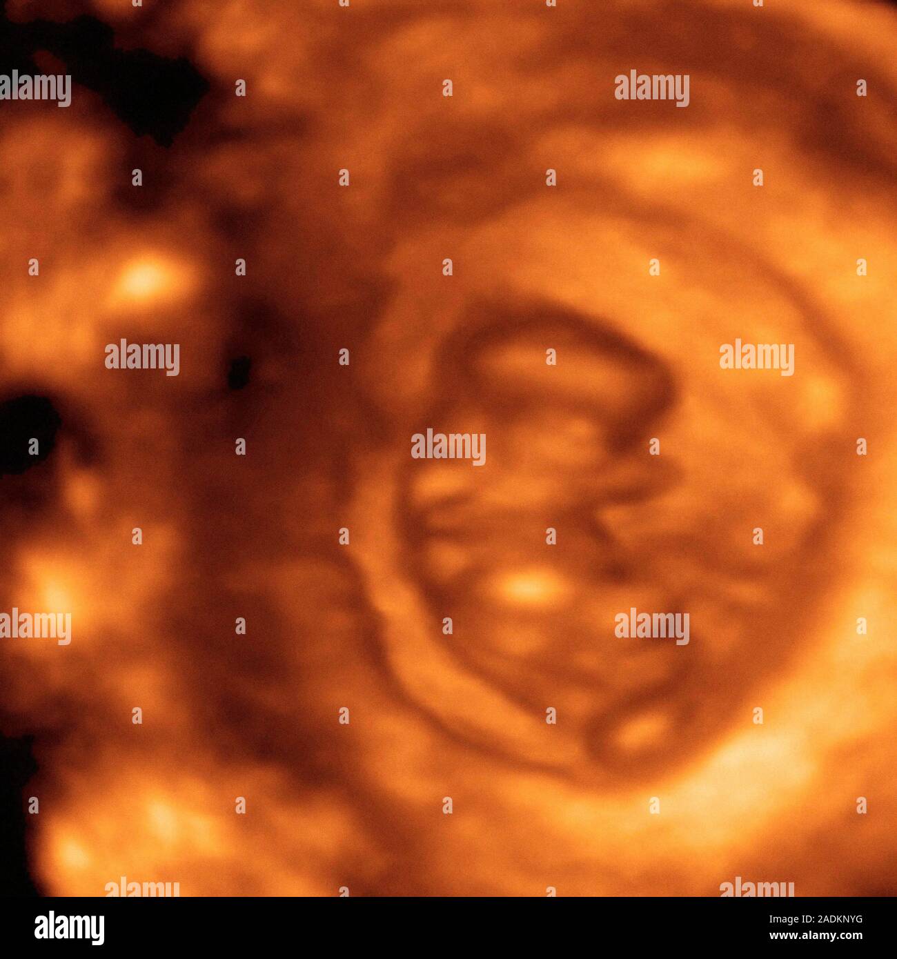 Foetus. Coloured 3-D ultrasound scan of a foetus inside a womb ...