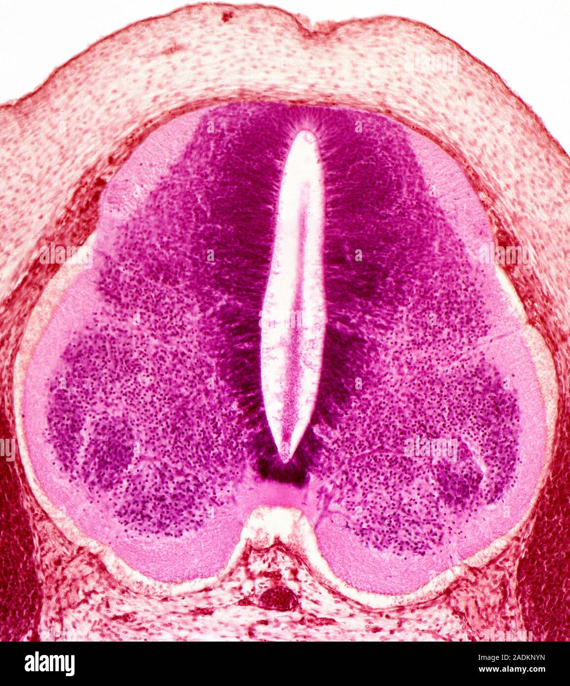 Embryo spinal cord. Coloured light micrograph of a section through the ...