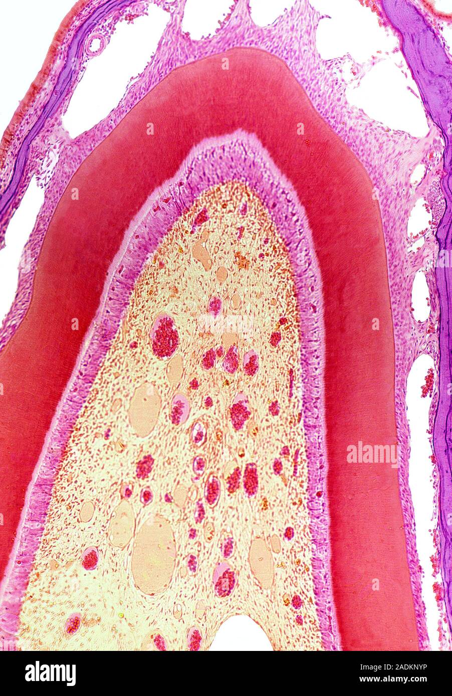 Foetal tooth. Coloured light micrograph showing an unerupted foetal ...
