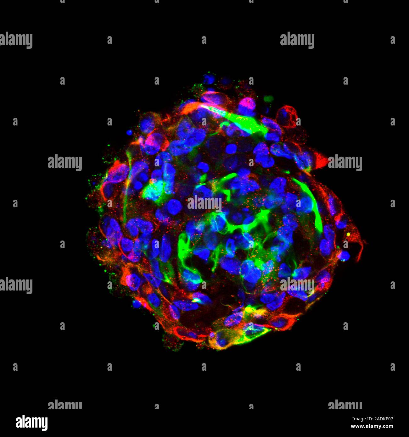 Early embryo. Confocal light micrograph of an early embryo showing ...