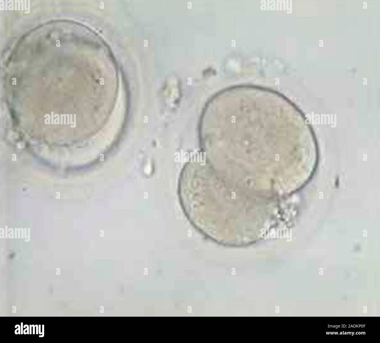 2-cell embryos. Light micrograph of two 2-cell embryos. The development ...
