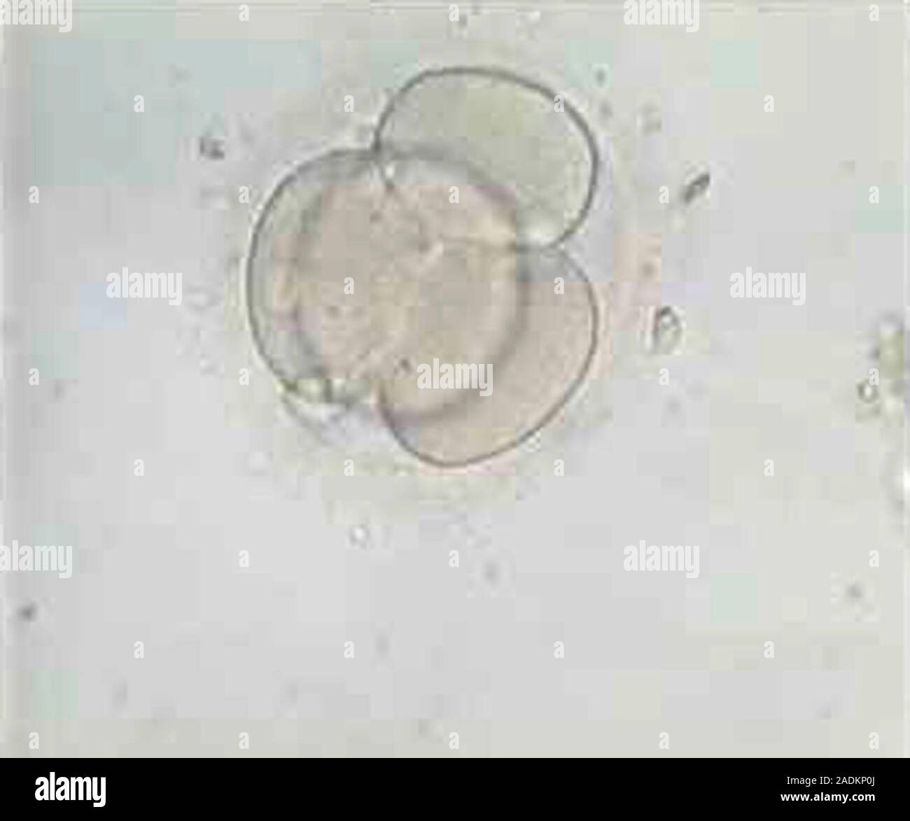 4-cell embryo, light micrograph. The development of an embryo is called ...
