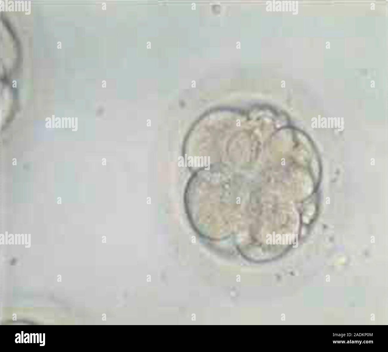 Multi-celled embryo. Light micrograph of an embryo, showing between 6 ...