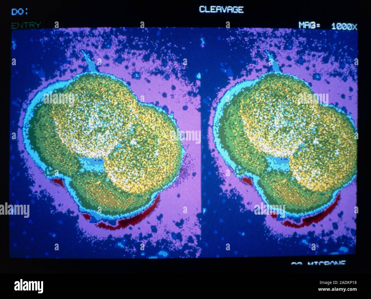 Computer-enhanced scanning electron micrograph (SEM) showing 2 views of ...