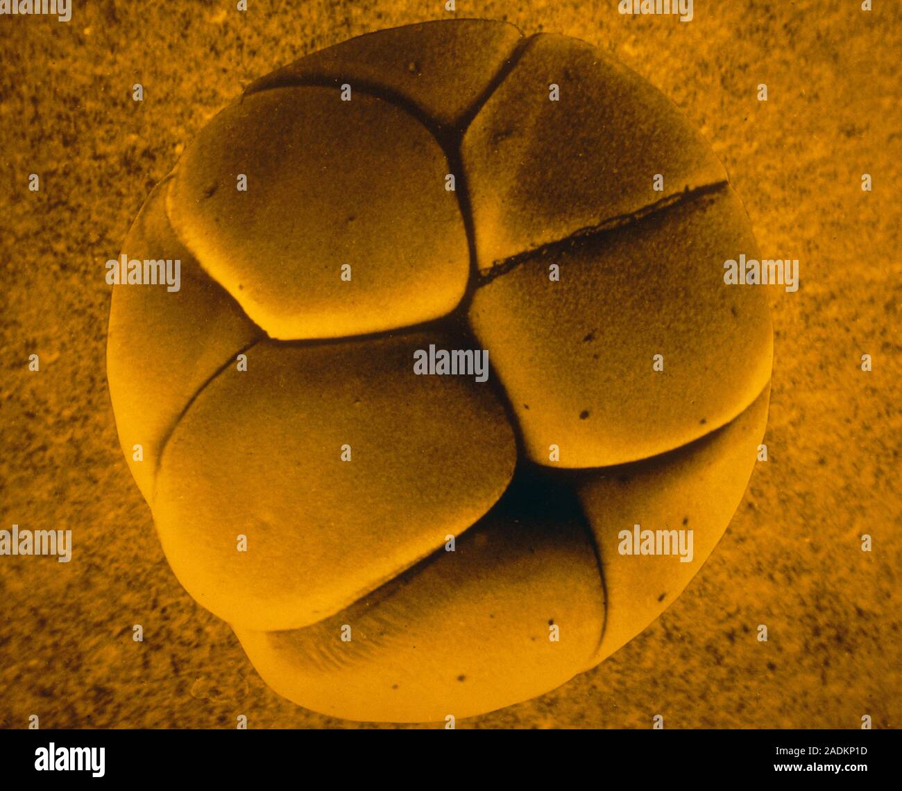 False-colour scanning electron micrograph (SEM) of a fertilised frog ...