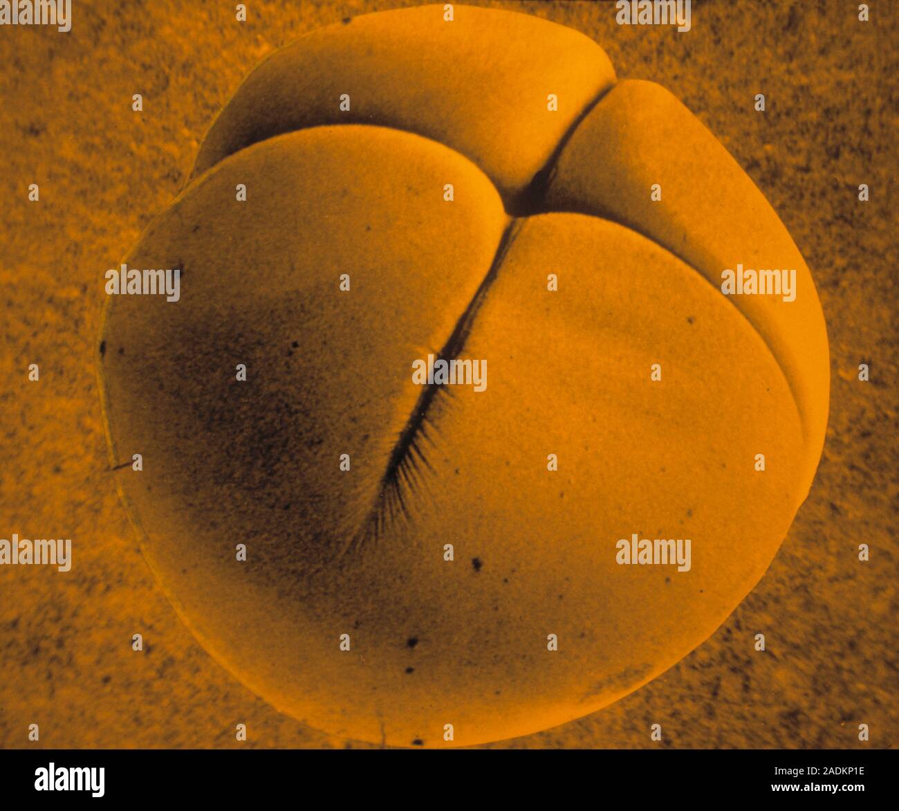 False-colour scanning electron micrograph (SEM) of a fertilised frog ...